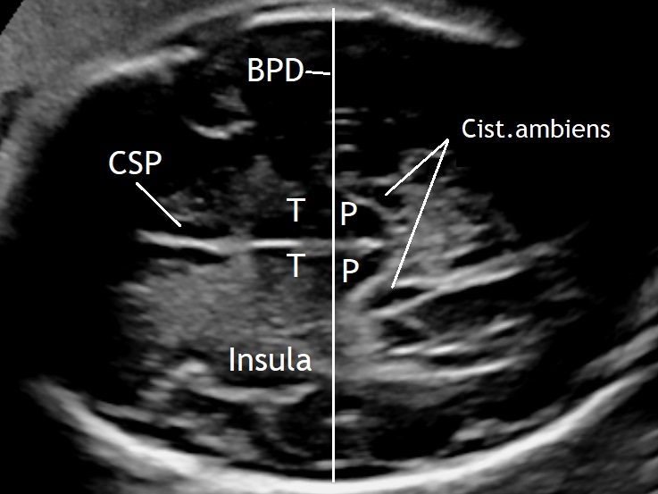 Fetal Biometry Series – Gynaecologia